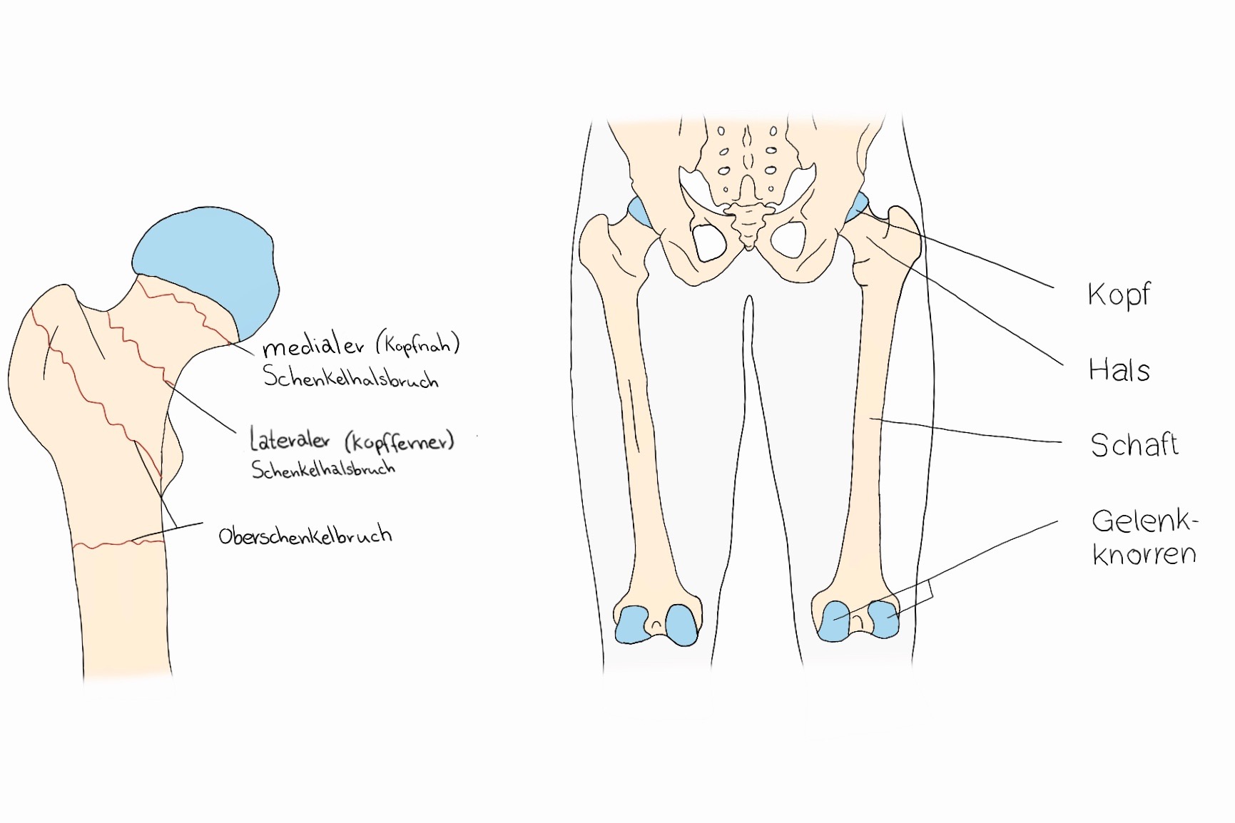 Oberschenkelhalsfraktur – Physiotherapie & Osteopathie Beger | Leipzig Böhlitz-Ehrenberg